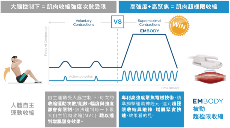 EMBODY增肌減脂有效嗎?靠EMBODY長腹肌可行?Embody醫美價格、原理1次瞭解! - 原美學診所